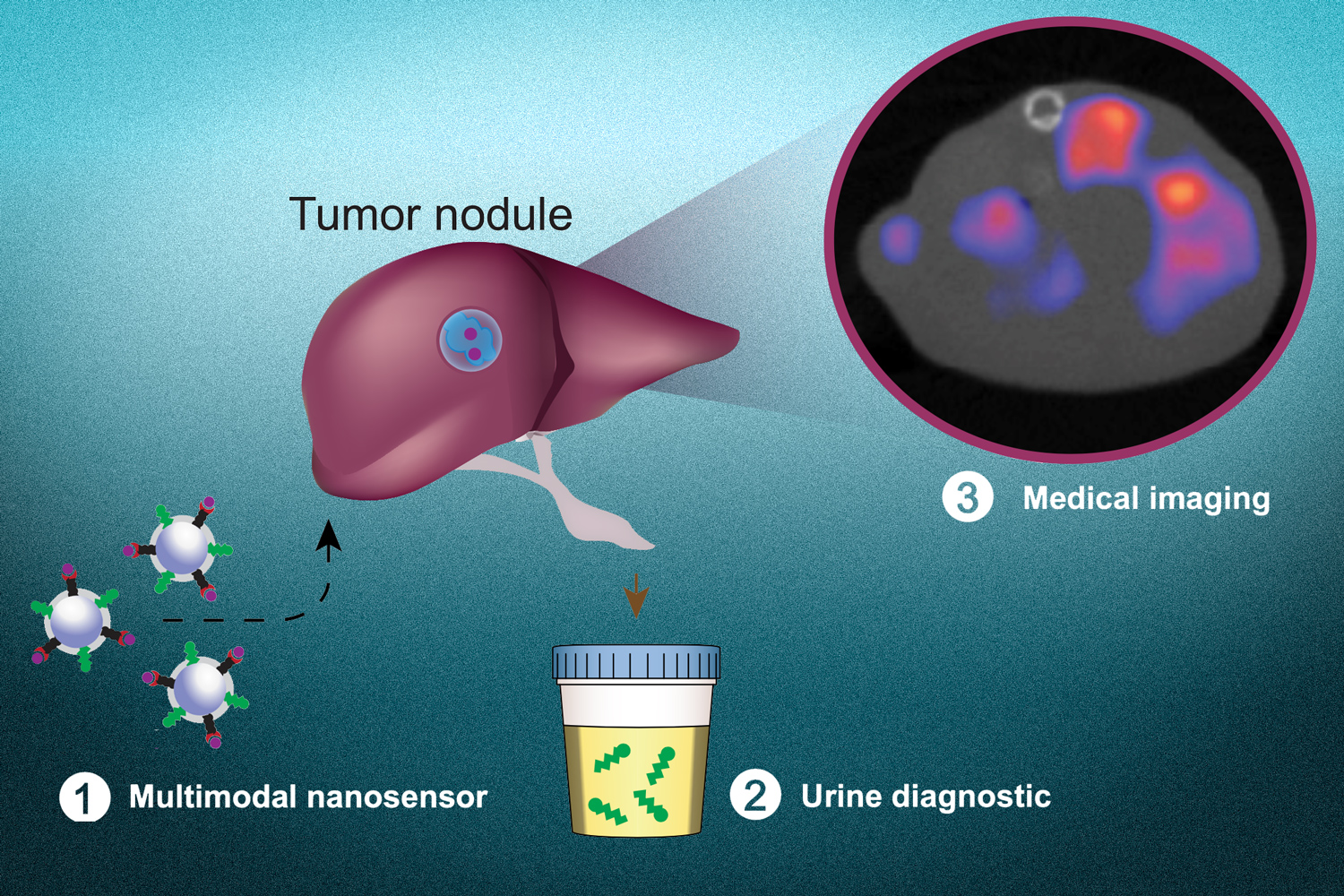A Noninvasive Test To Detect Cancer Cells And Pinpoint Their Location