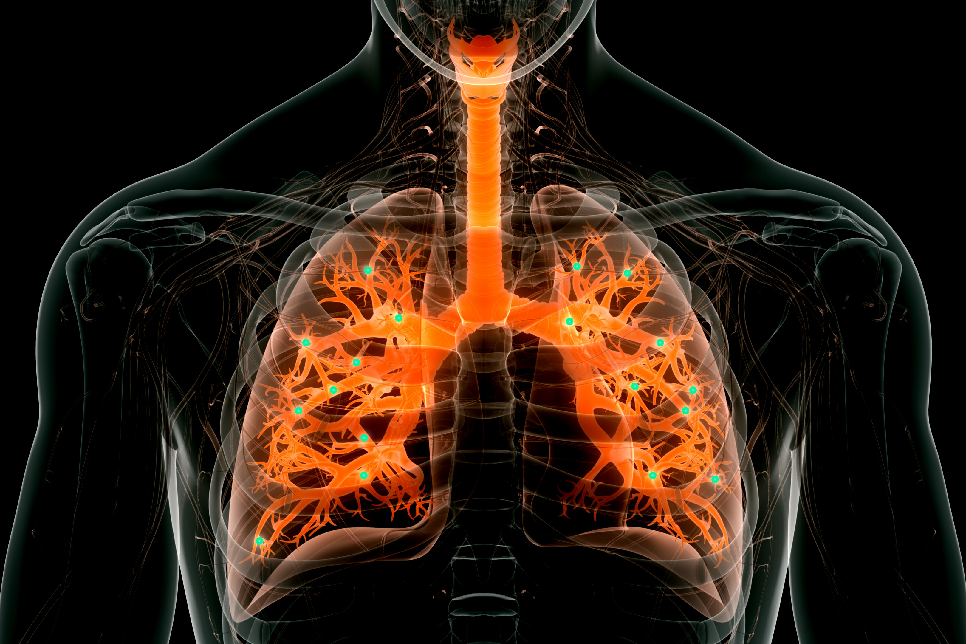 New Nanoparticles Can Perform Gene Editing In The Lungs MIT News New Nanoparticles Can Perform Gene Editing In The Lungs MIT News