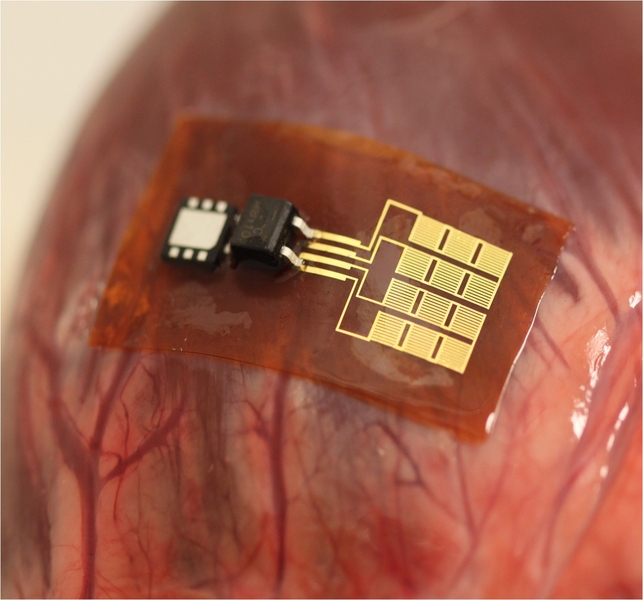 Canan Dagdeviren joins the Media Lab | MIT News | Massachusetts ... Canan Dagdeviren joins the Media Lab | MIT News | Massachusetts ...